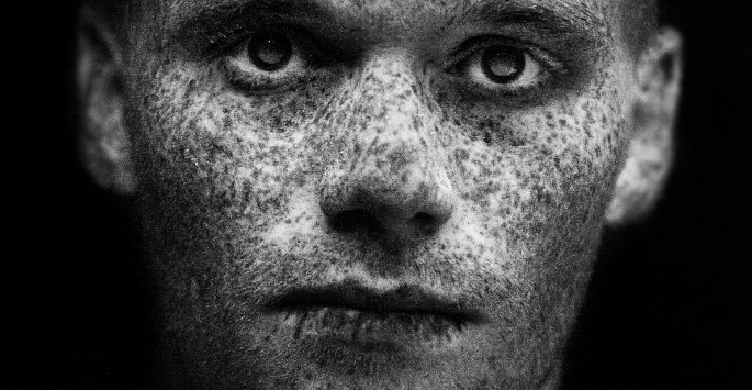 3 Photos That Will Make You Start Wearing Sunscreen – SupriyaMD Skincare
